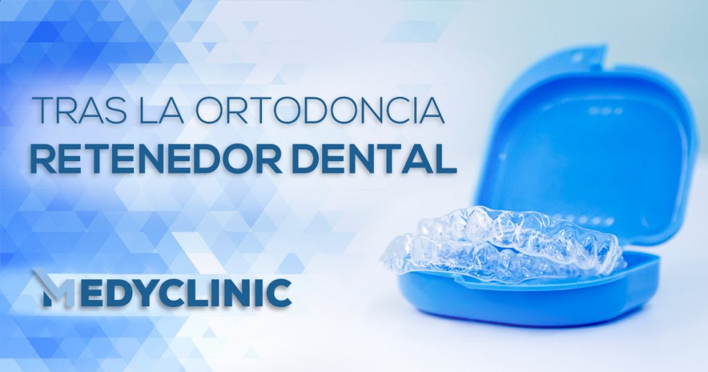 Retenedor dental tras la ortodoncia - Medyclinic, tu clínica dental